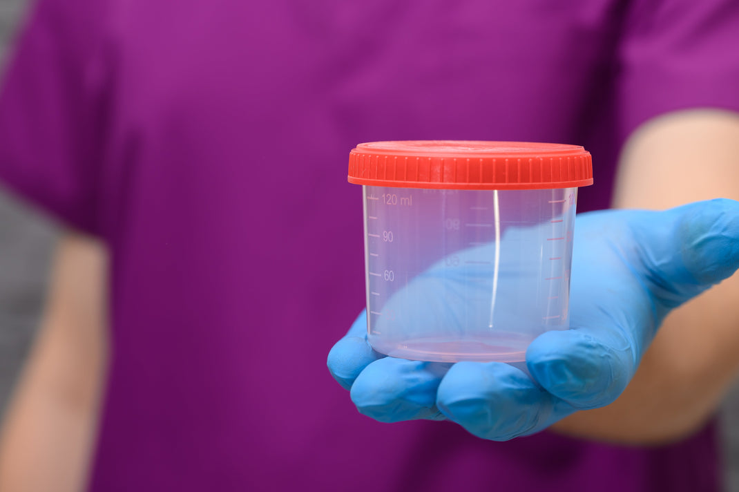 Sample Containers – Medisave UK