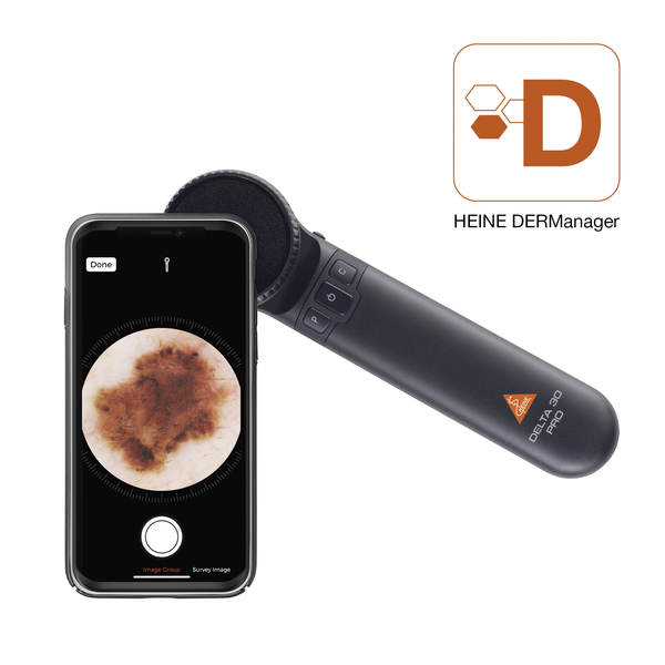 HEINE DELTA 30 PRO Dermatoscope - Bundle – Medisave UK