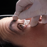 Morgan Lens - Eye Irrigation (Medi-Flow Lens) – Medisave UK