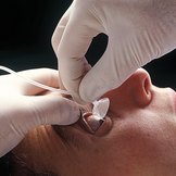 Morgan Lens - Eye Irrigation (Medi-Flow Lens) – Medisave UK