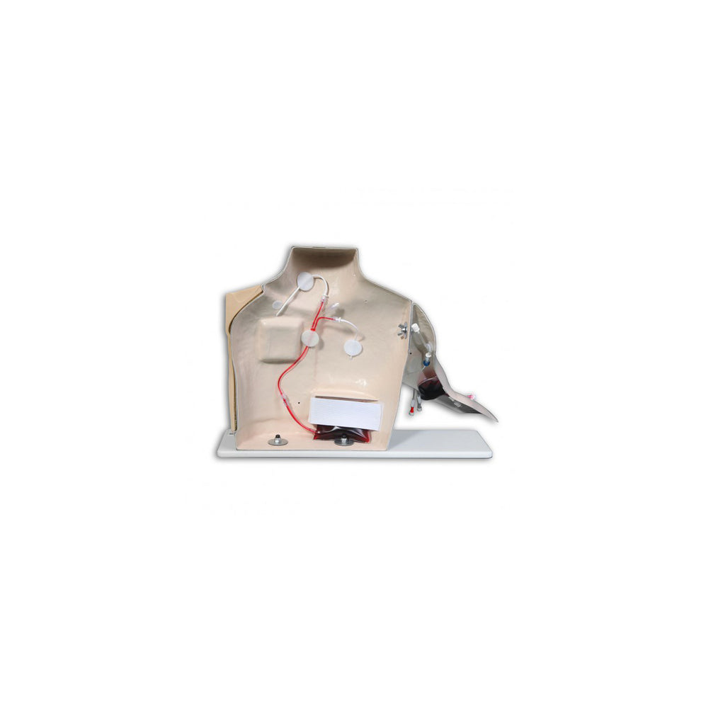 Chester Chest™ with Port Access Arm - Light Skin – Medisave UK