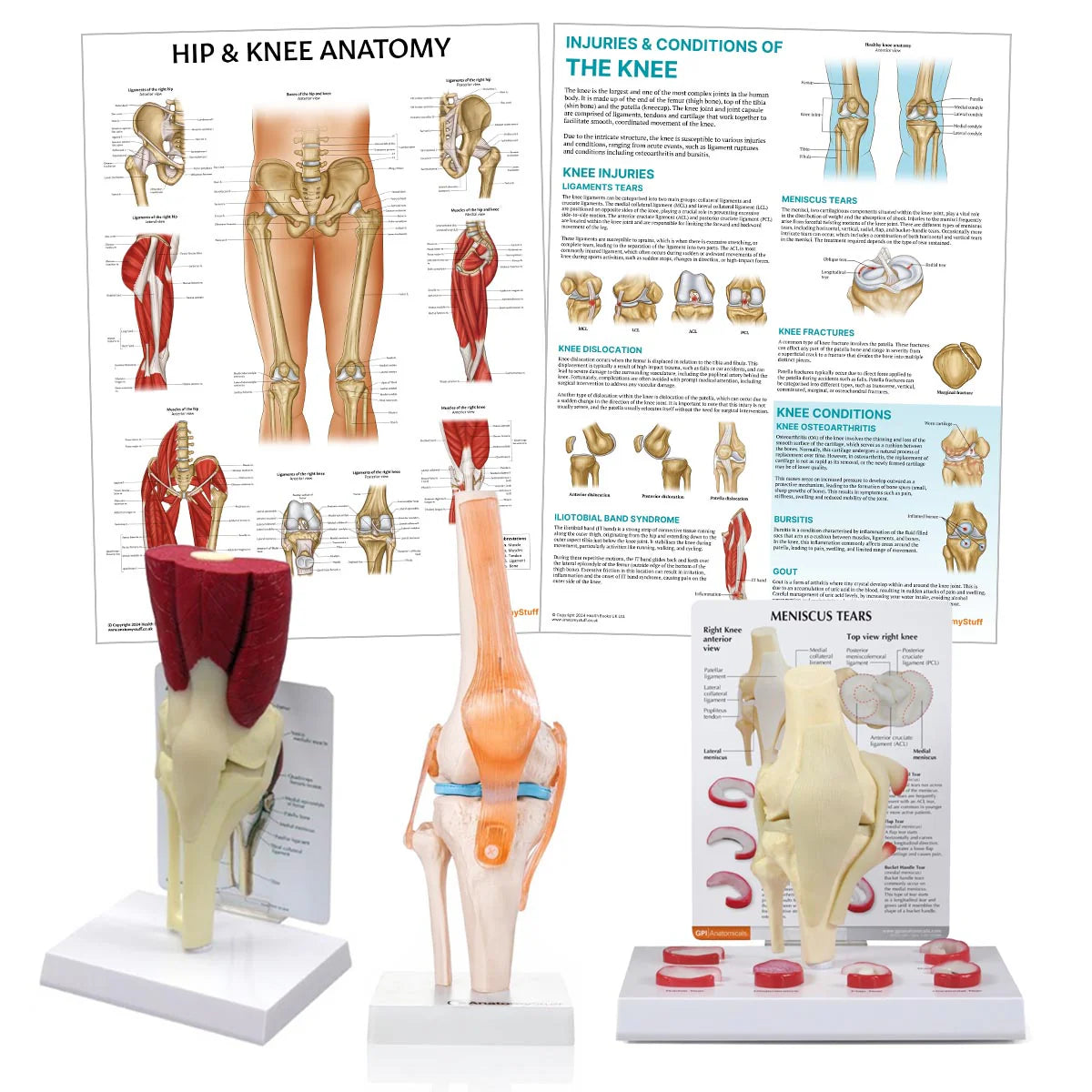 Knee Anatomy & Pathology Collection – Medisave UK