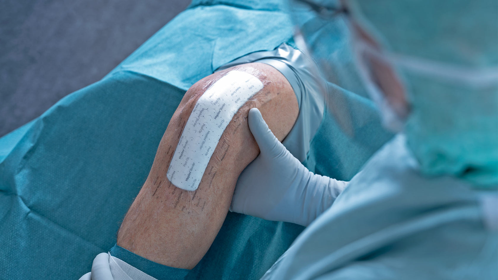 Mepilex Boarder Post Op Dressing - 10cm x 15cm - Box of 10 – Medisave UK