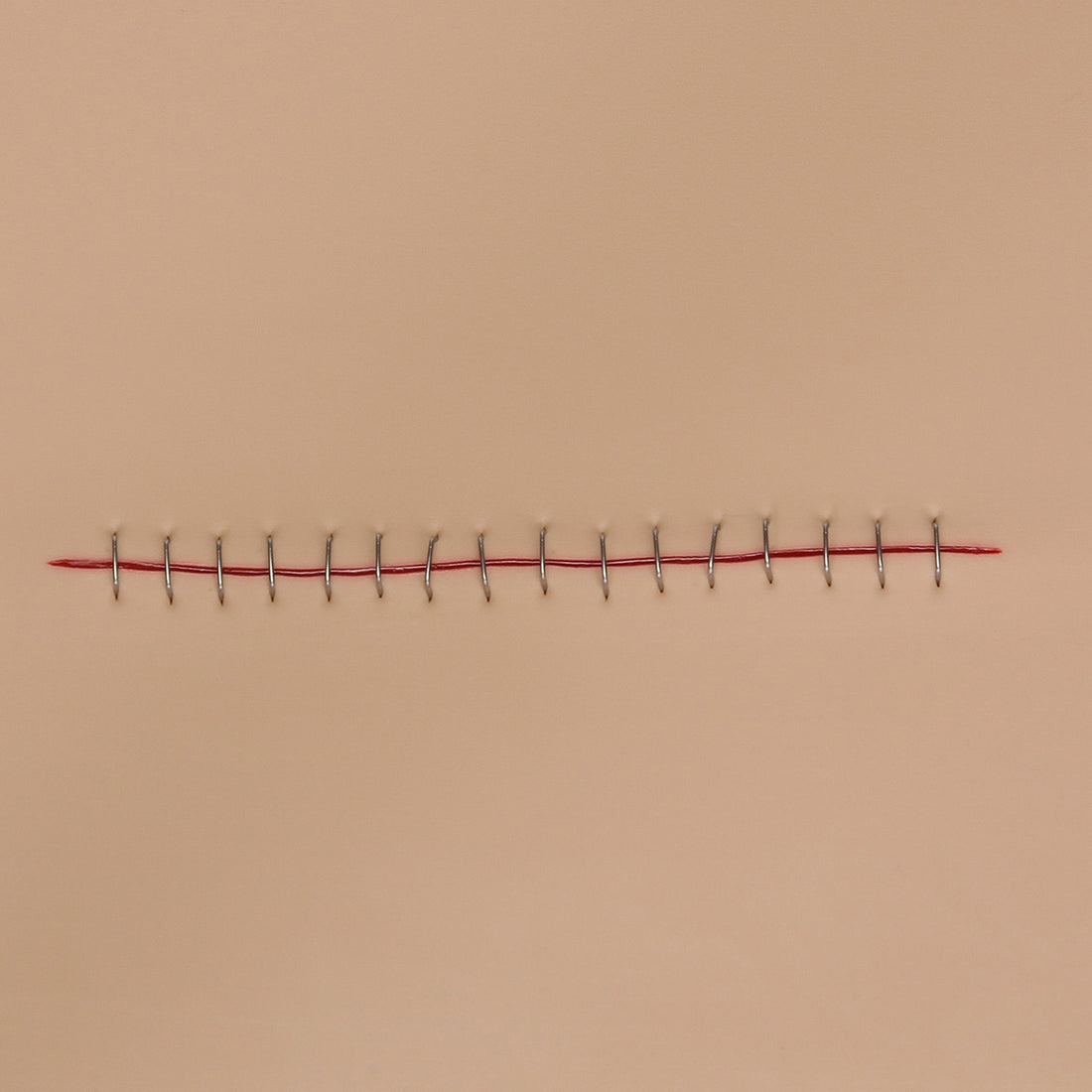 Stapled Incision Wound Board, light – Medisave UK