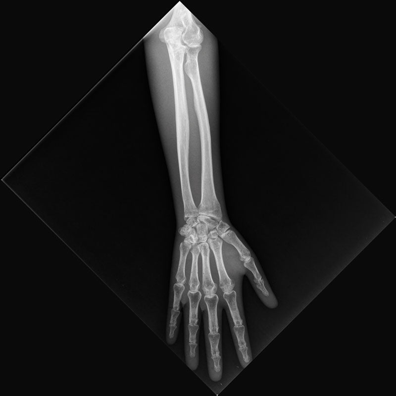 X-Ray Phantom Foot - Transparent – Medisave UK