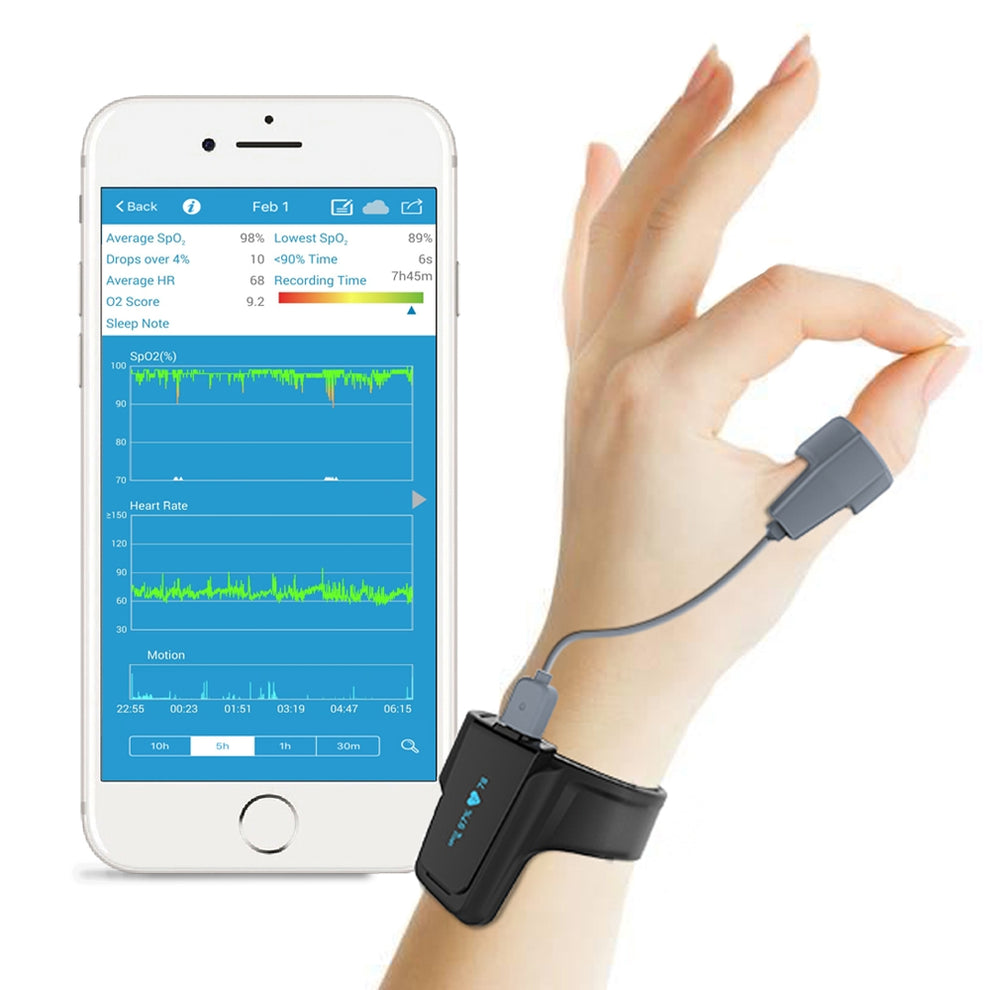 Viatom Wireless Checkme Pulse Oximeter O2 – Medisave UK