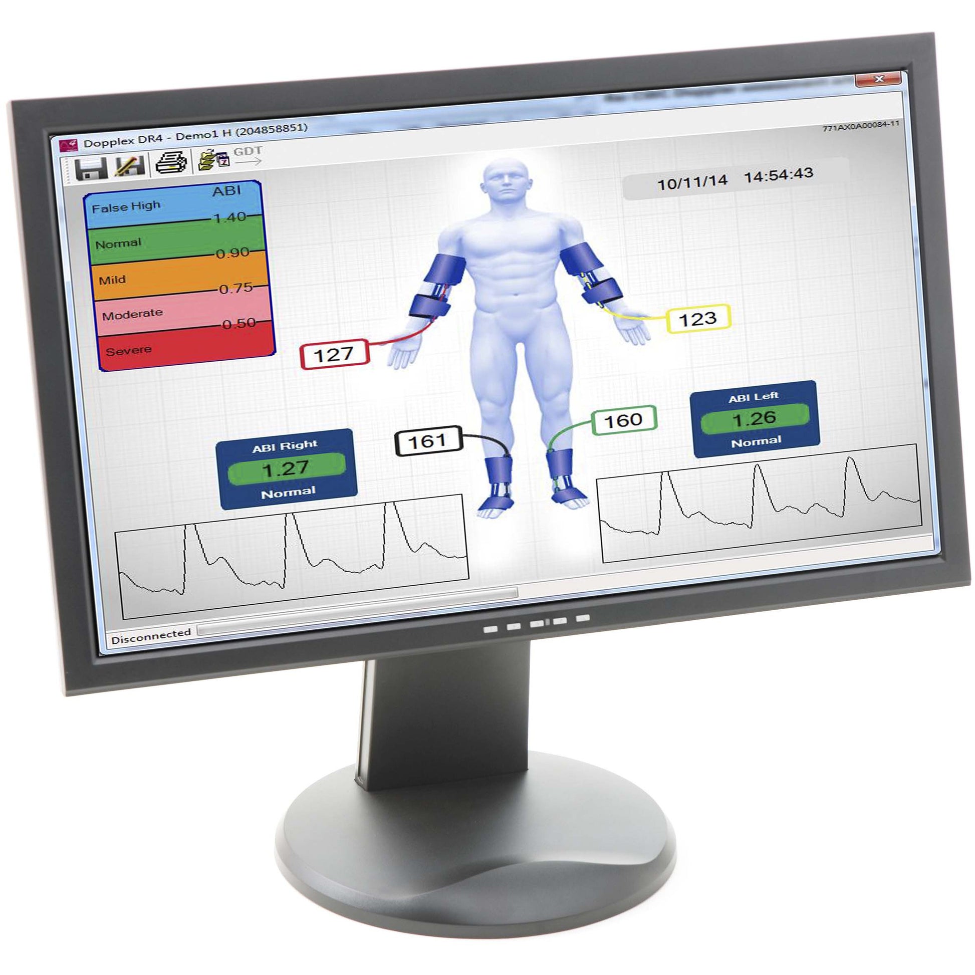 Dopplex reporter software package for multiple PCs - version 4 multi-l ...