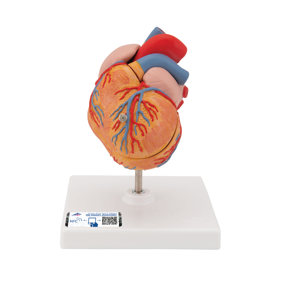 Classic Human Heart Model with Left Ventricular Hypertrophy (LVH), 2 p ...