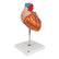 Human Heart Model, 2-times Life-Size, 4 part – Medisave UK