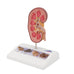 Kidney Stone Model – Medisave UK