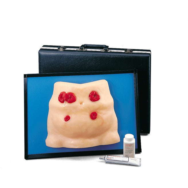 Ostomy Care Model – Medisave UK