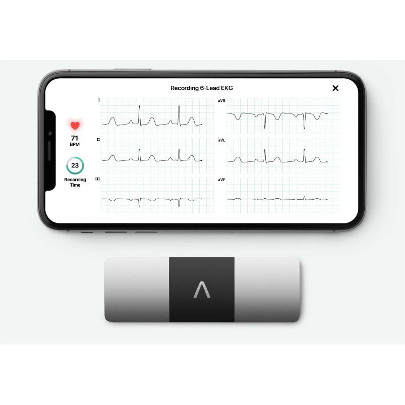 AliveCor KardiaMobile ECG 6 Lead – Medisave UK