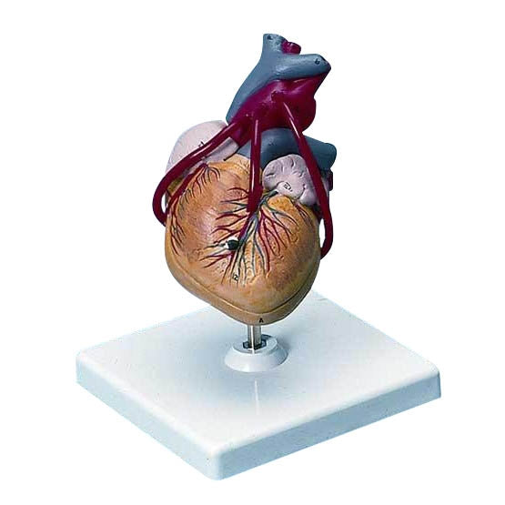 Heart Model with Bypass - CLEARANCE – Medisave UK