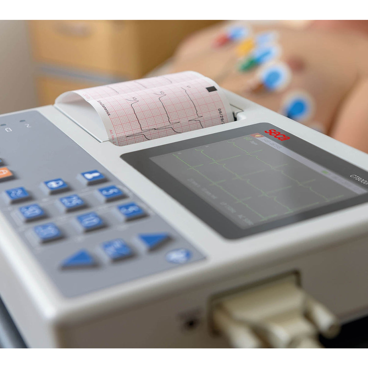 seca CT8000i-2 2nd Generation 12 Lead ECG - With Free 5 Year Warranty ...