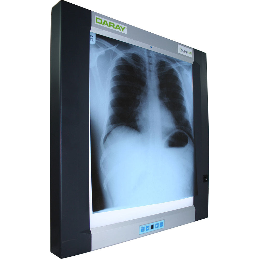 Daray Double Panel X-Ray Viewer - LED – Medisave UK