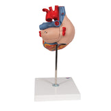 Human Heart Model, 2-times Life-Size, 4 part – Medisave UK