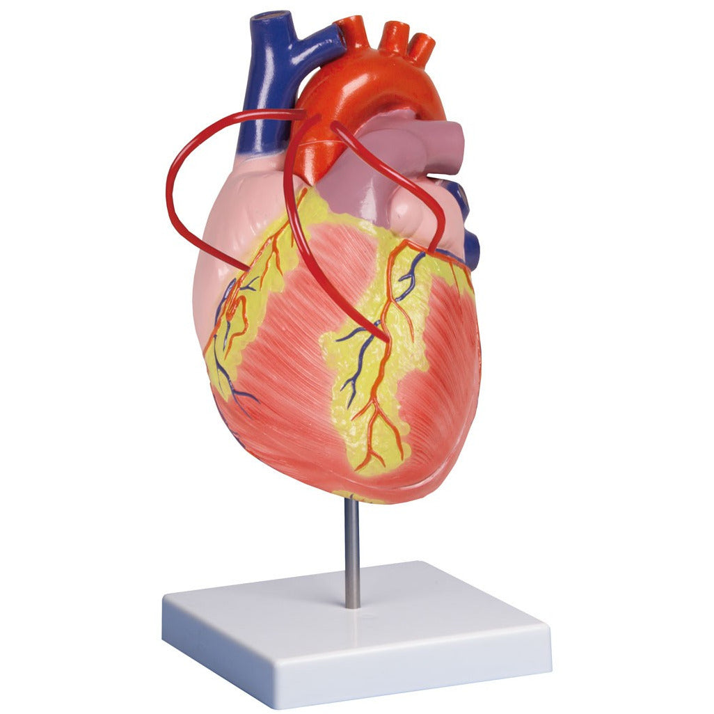 Heart Model with Bypass - 2 Times Life-Size, 2 Parts – Medisave UK