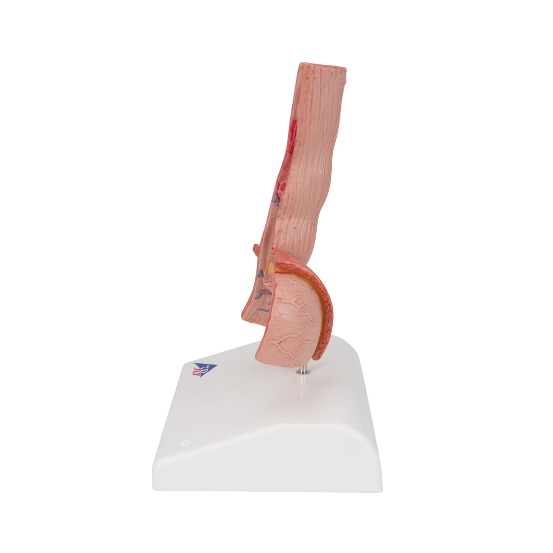 Life-Size Human Esophagus Diseases Model – Medisave UK