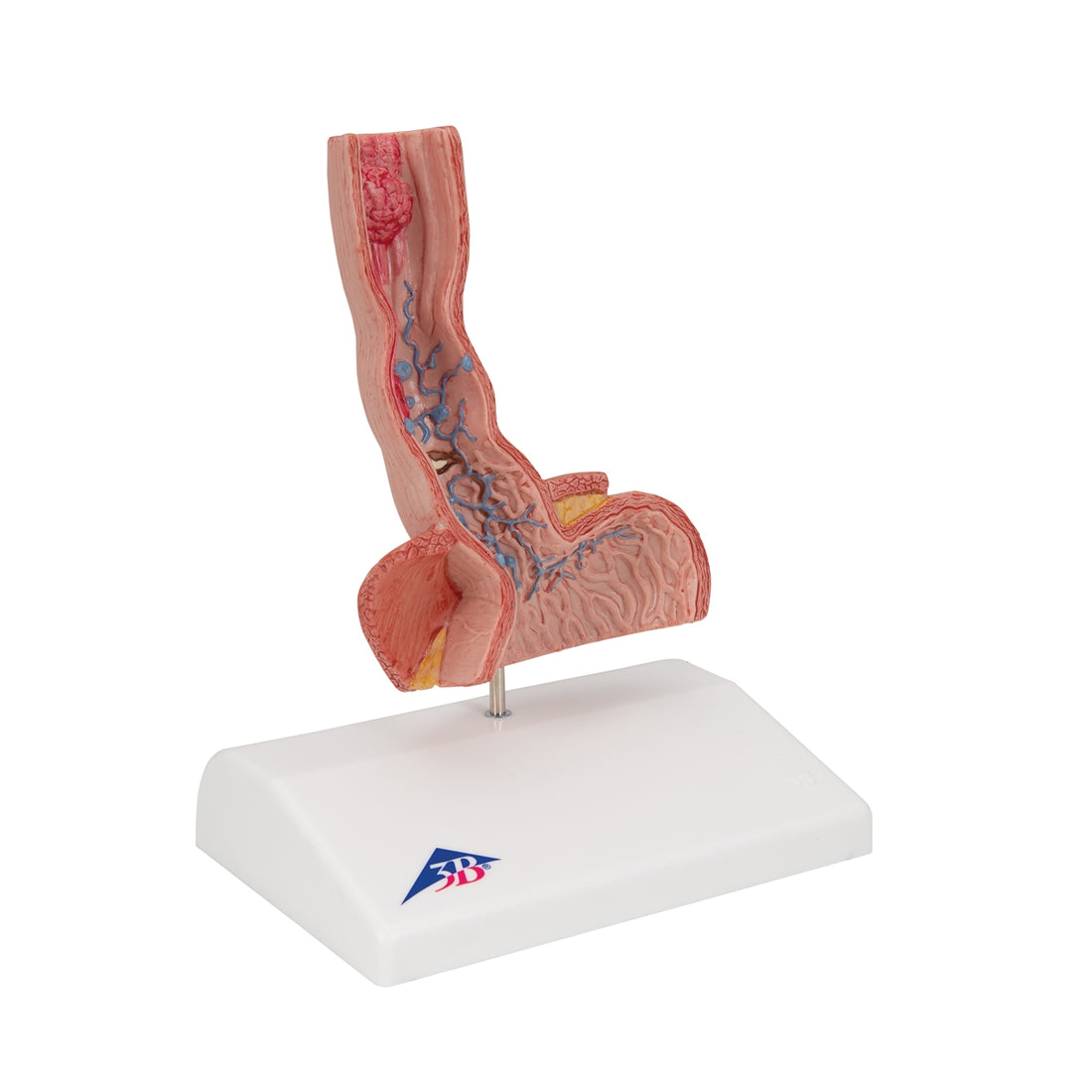 Life-Size Human Esophagus Diseases Model – Medisave UK