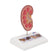 Kidney Stone Model – Medisave UK