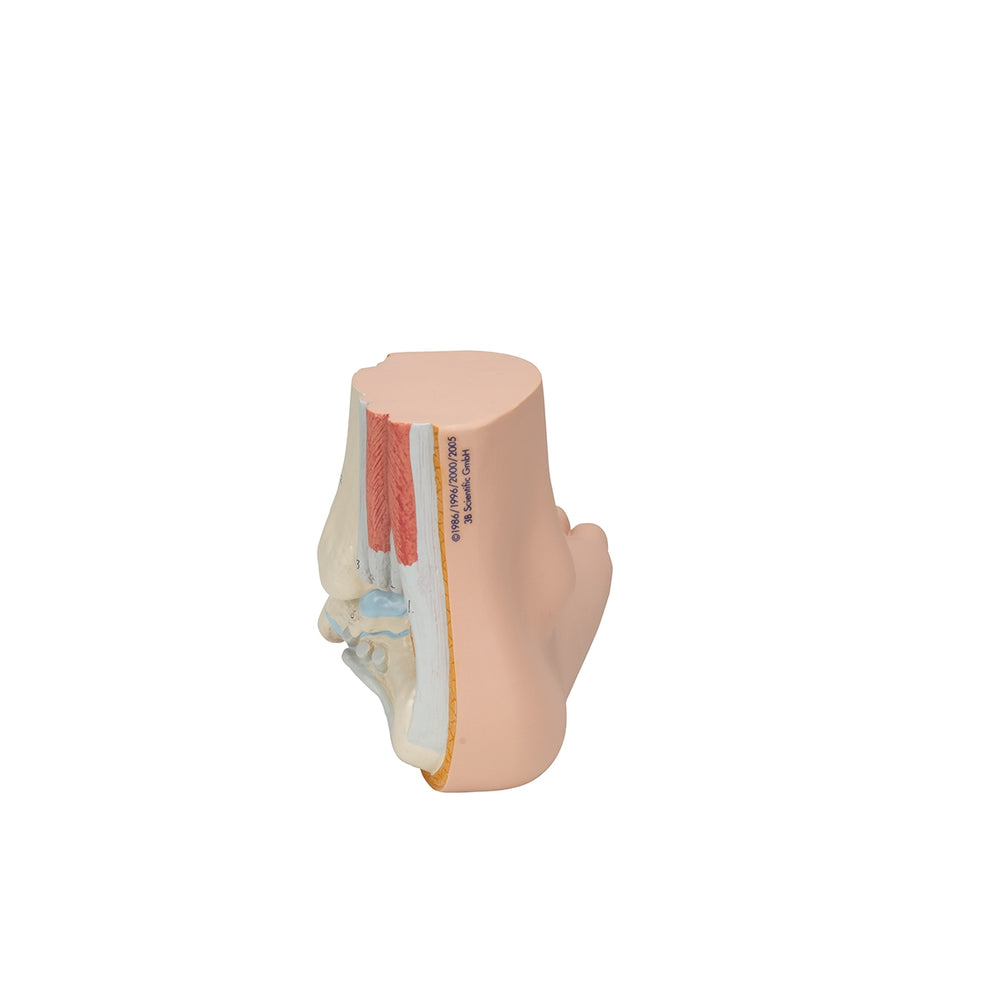 Flat Foot (Pes Planus) Model – Medisave UK