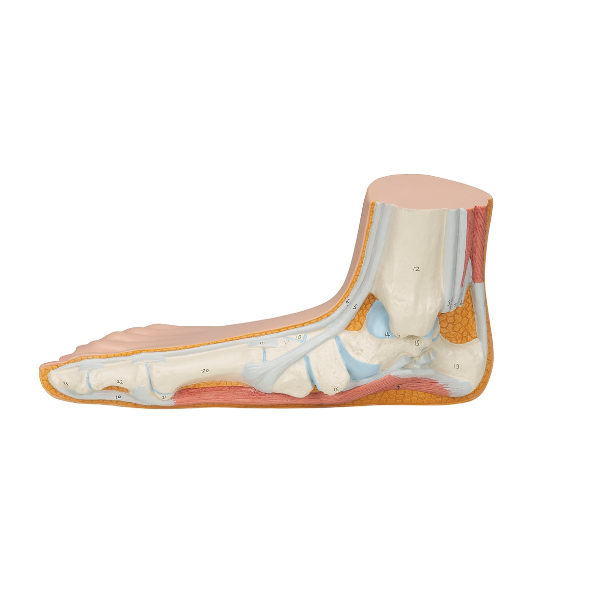 Flat Foot (Pes Planus) Model – Medisave UK