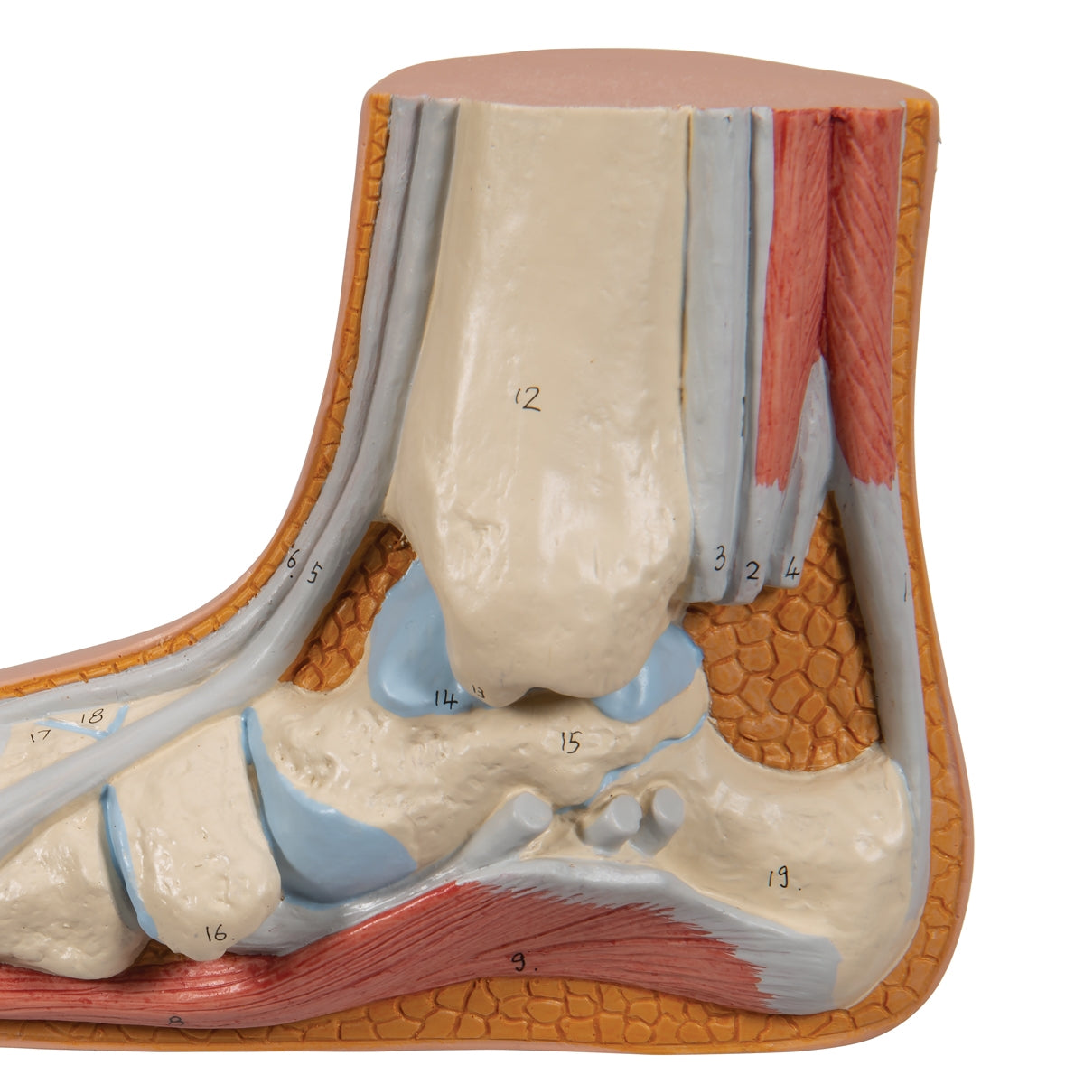 Flat Foot (Pes Planus) Model – Medisave UK