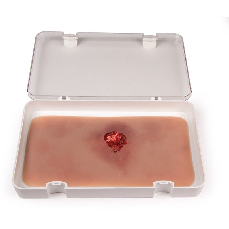 Wound Moulage Open Fracture, Arm Bone With Bleeding Function – Medisave UK