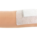 Softpore - Adhesive Surgical Dressing - 10x10cm x 50